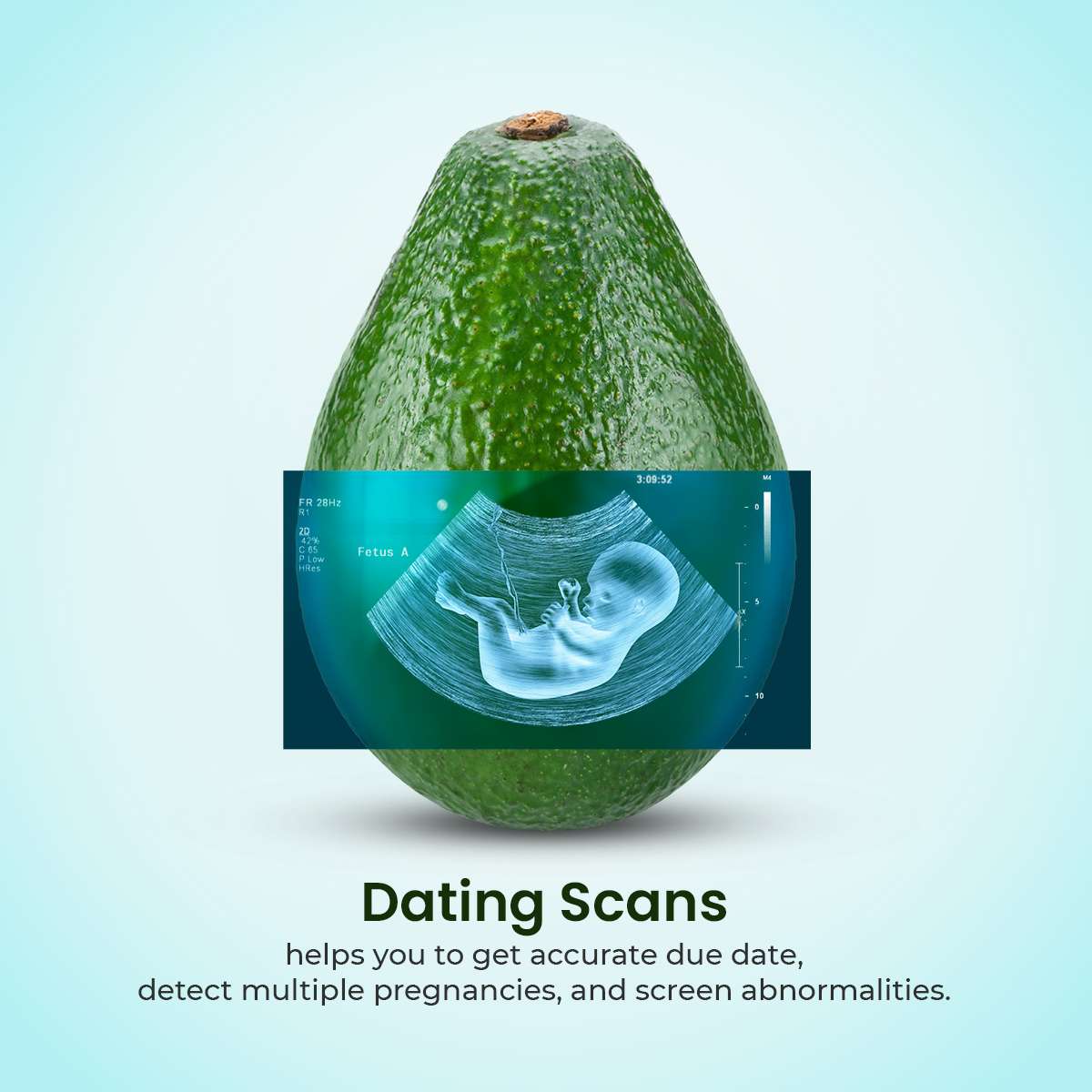 How Is A Fetal Anomaly Scan Done Mind Mom How Is A Fetal Anomaly Scan Done Mind Mom